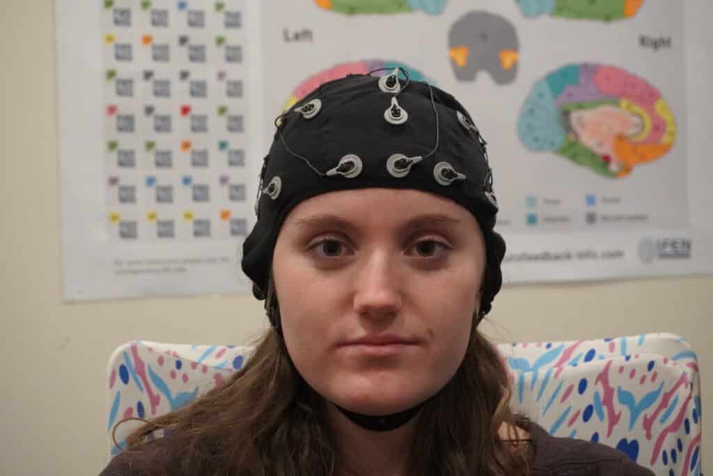 Neurofeedback o estimulación magnética transcraneal en la migraña ...